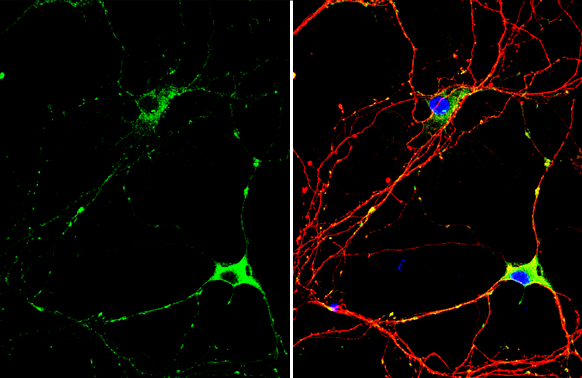 CaMKII抗体 (GTX135117) | GeneTex中国官方网站