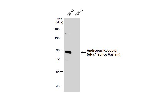 Androgen Receptor (ARv7 Splice Variant)抗体 (GTX135345) | GeneTex中国官方网站