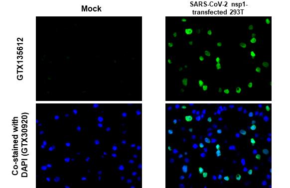 Anti-SARS-CoV-2 (COVID-19) nsp1 antibody (GTX135612) | GeneTex