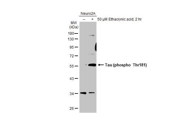 Tau (phospho Thr181)抗体 (GTX135776) | GeneTex中国官方网站
