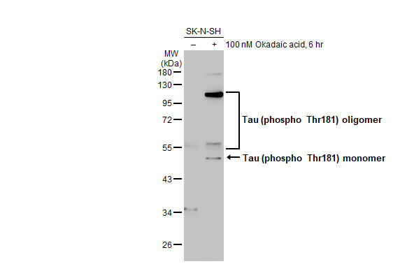 Tau (phospho Thr181)抗体 (GTX135776) | GeneTex中国官方网站