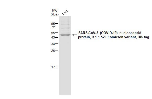 SARS-CoV-2 (COVID-19) Nucleocapsid protein, Omicron / BA.1 variant, His tag (GTX136779-pro ...