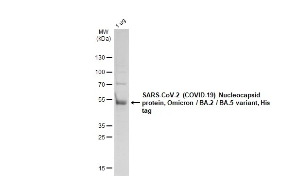 SARS-CoV-2 (COVID-19) Nucleocapsid protein, Omicron / BA.2 / BA.5 ...