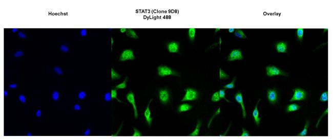 STAT3抗体 [9D8] (GTX15789) | GeneTex中国官方网站