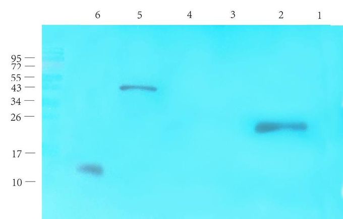 CGRP抗体 (GTX16211) | GeneTex中国官方网站