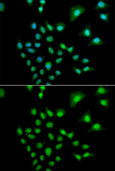 UBE3C抗体 (GTX16467) | GeneTex中国官方网站