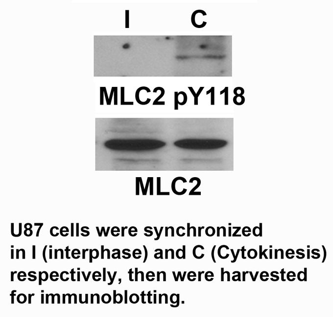 Myosin Light Chain 2 (MLC-2v) (phospho Tyr118)抗体 (GTX17511) | GeneTex中国官方网站