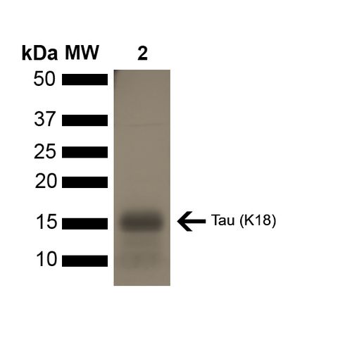 Human Tau (K18) 蛋白, mutant P301L (monomer) (GTX17673-pro) | GeneTex中国官方网站