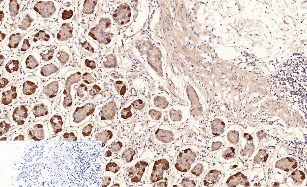 NFkB p65 (acetyl Lys310)抗体 (GTX20308) | GeneTex中国官方网站