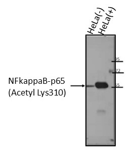 NFkB p65 (acetyl Lys310)抗体 (GTX20308) | GeneTex中国官方网站