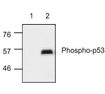 p53 (phospho Ser15)抗体 (GTX21431) | GeneTex中国官方网站