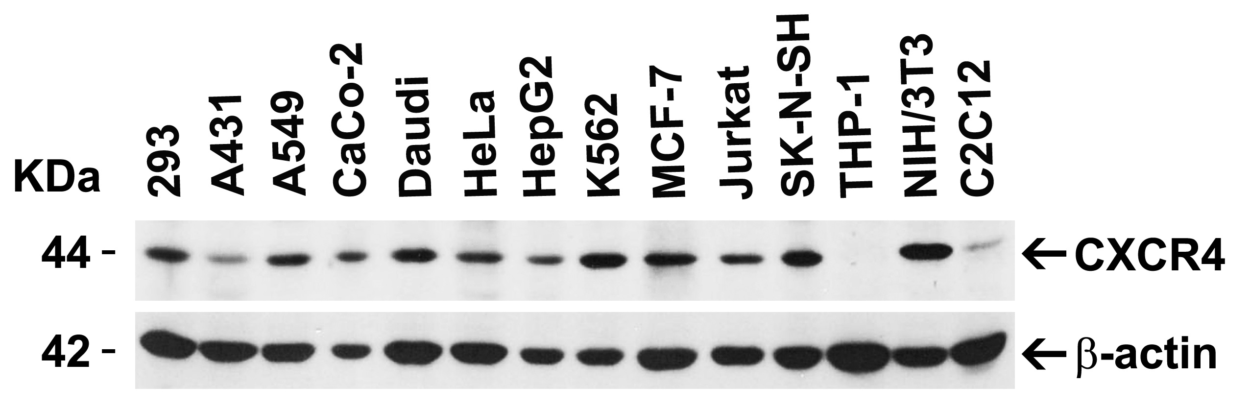 CXCR4抗体 (GTX22090) | GeneTex中国官方网站