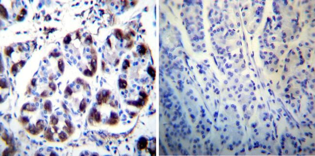 Hydrogen Potassium ATPase Beta抗体 [2G11] (GTX22866) | GeneTex中国官方网站