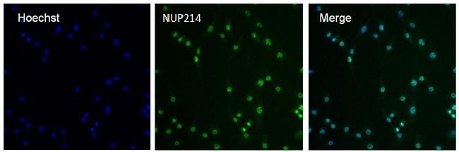 NUP214抗体 (GTX23349) | GeneTex中国官方网站