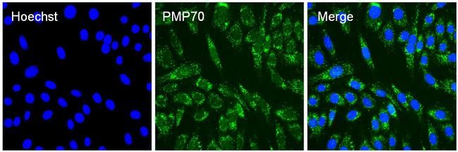 PMP70抗体 (GTX23421) | GeneTex中国官方网站