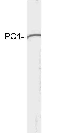 PC1 antibody价格,详情介绍-960化工网 – 960化工网