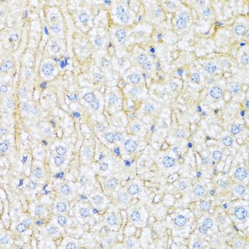 ABCA6抗体 (GTX30015) | GeneTex中国官方网站