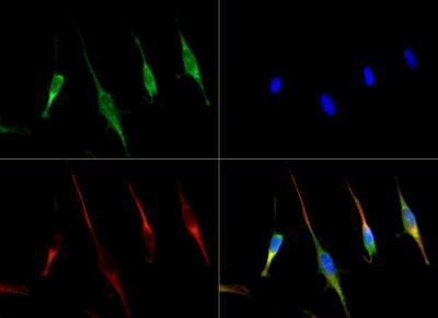 SLC31A1 / CTR1抗体 (GTX30642) | GeneTex中国官方网站