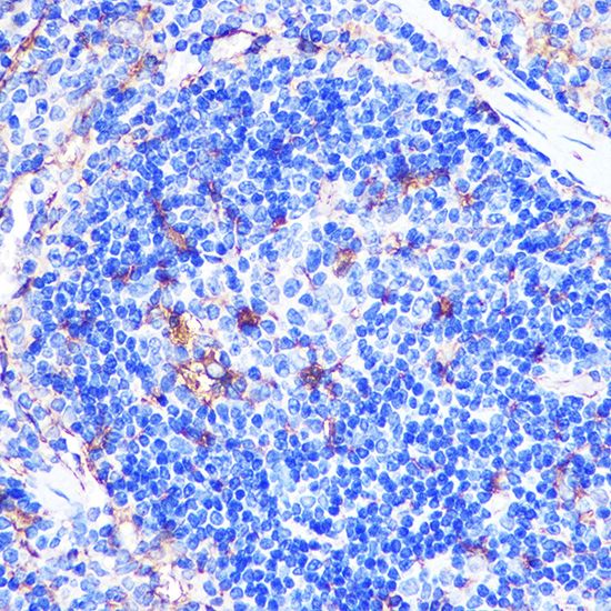 CD86抗体 (GTX32507) | GeneTex中国官方网站