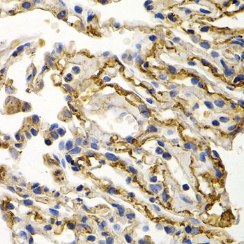 Clusterin抗体 (GTX32529) | GeneTex中国官方网站