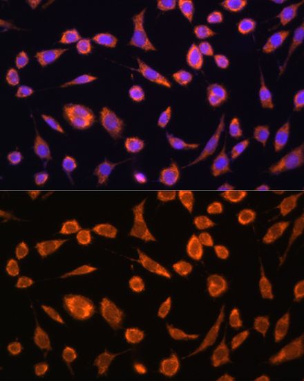 TOMM20抗体 (GTX32928) | GeneTex中国官方网站