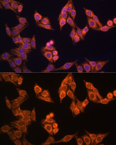 TOMM20抗体 (GTX32928) | GeneTex中国官方网站