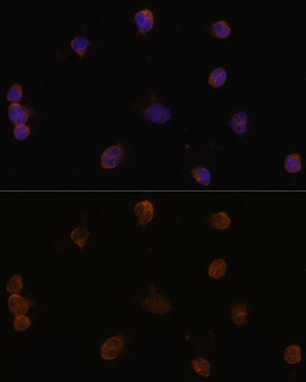 VGAT抗体 (GTX32964) | GeneTex中国官方网站