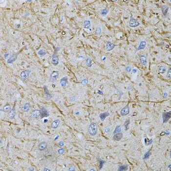 VGAT抗体 (GTX32964) | GeneTex中国官方网站