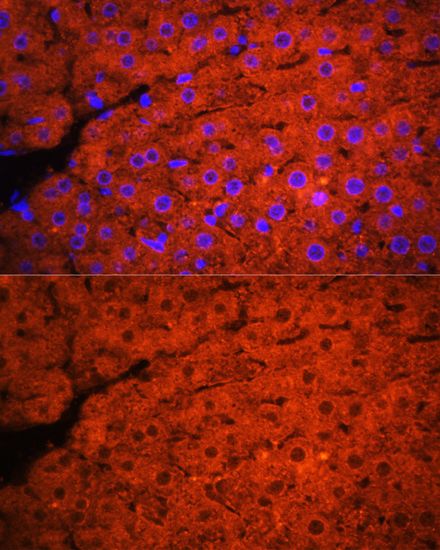 C3 / C3c抗体 (GTX33050) | GeneTex中国官方网站