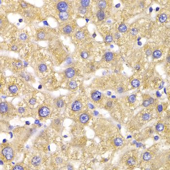 GPD2抗体 (GTX33225) | GeneTex中国官方网站