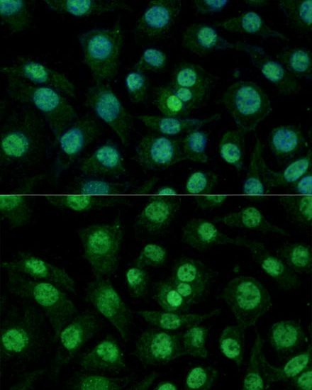 hnRNP M抗体 (GTX33245) | GeneTex中国官方网站