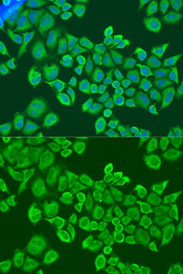 IGF2BP2抗体 (GTX33256) | GeneTex中国官方网站