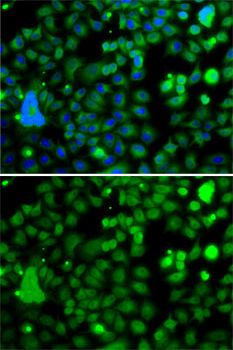 KLF9抗体 (GTX33288) | GeneTex中国官方网站
