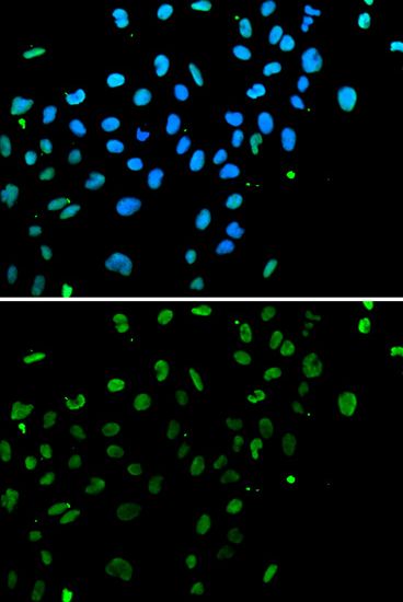 Ku80抗体 (GTX33290) | GeneTex中国官方网站