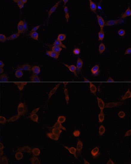 LAMP1抗体 (GTX33293) | GeneTex中国官方网站