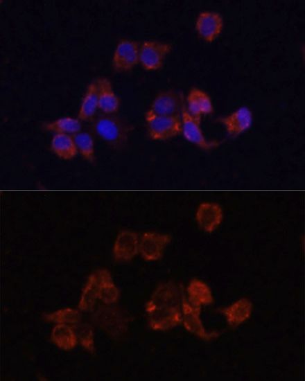 LAMP1抗体 (GTX33293) | GeneTex中国官方网站