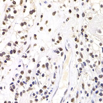 SOX5抗体 (GTX33514) | GeneTex中国官方网站