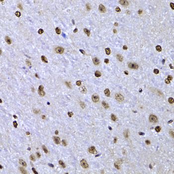 SOX5抗体 (GTX33514) | GeneTex中国官方网站