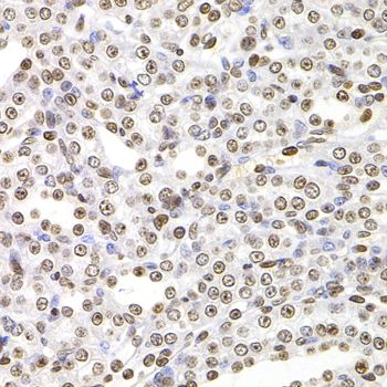 SOX5抗体 (GTX33514) | GeneTex中国官方网站