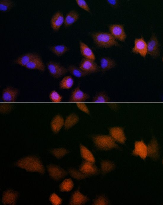 UBE2C抗体 (GTX33567) | GeneTex中国官方网站