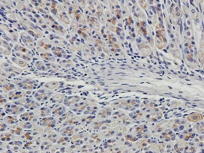 CD163抗体 (GTX35248) | GeneTex中国官方网站