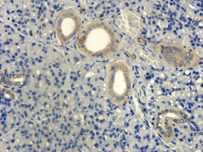 CD303抗体 (GTX37364) | GeneTex中国官方网站