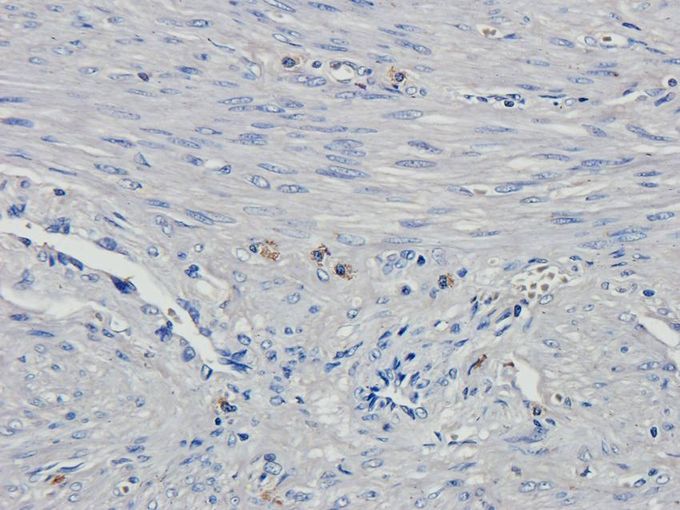 HOXA10抗体 (GTX37412) | GeneTex中国官方网站