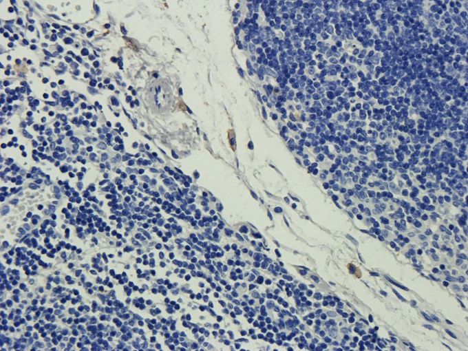 CD35抗体 (GTX37450) | GeneTex中国官方网站