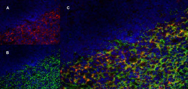 CD70抗体 [Bu69] (GTX41860) | GeneTex中国官方网站