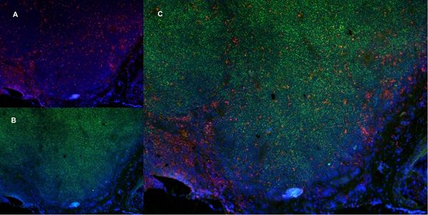 CD68抗体 [ED1] (GTX41868) | GeneTex中国官方网站