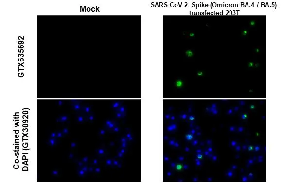 SARS-CoV-2 (COVID-19) Spike (Omicron BA.4 / BA.5) FFPE 293T Cell Pellet Block (GTX437396 ...