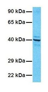 G6PC抗体, N-term (GTX46748) | GeneTex中国官方网站