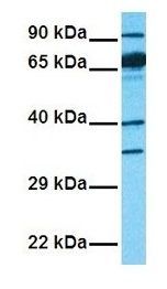 SLC6A2抗体, Internal (GTX47102) | GeneTex中国官方网站