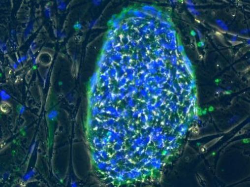 SSEA-4 antibody [MC-813-70]价格,详情介绍-960化工网 – 960化工网